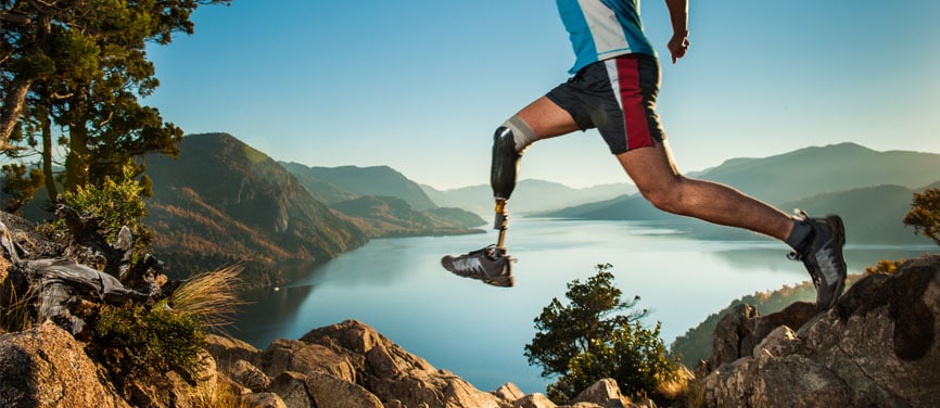 When the Success of a Bond Influences a Life: Prosthetic Attachment